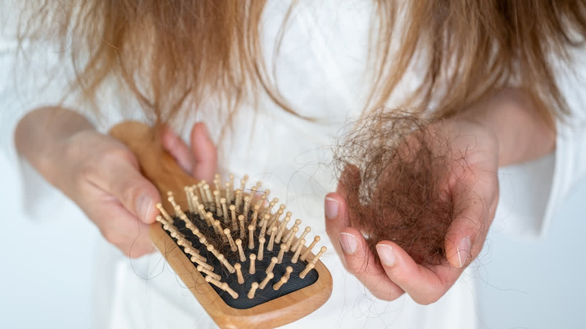 Is Iron Deficiency Causing Hair Loss Among Youth? Here's All You Need ...