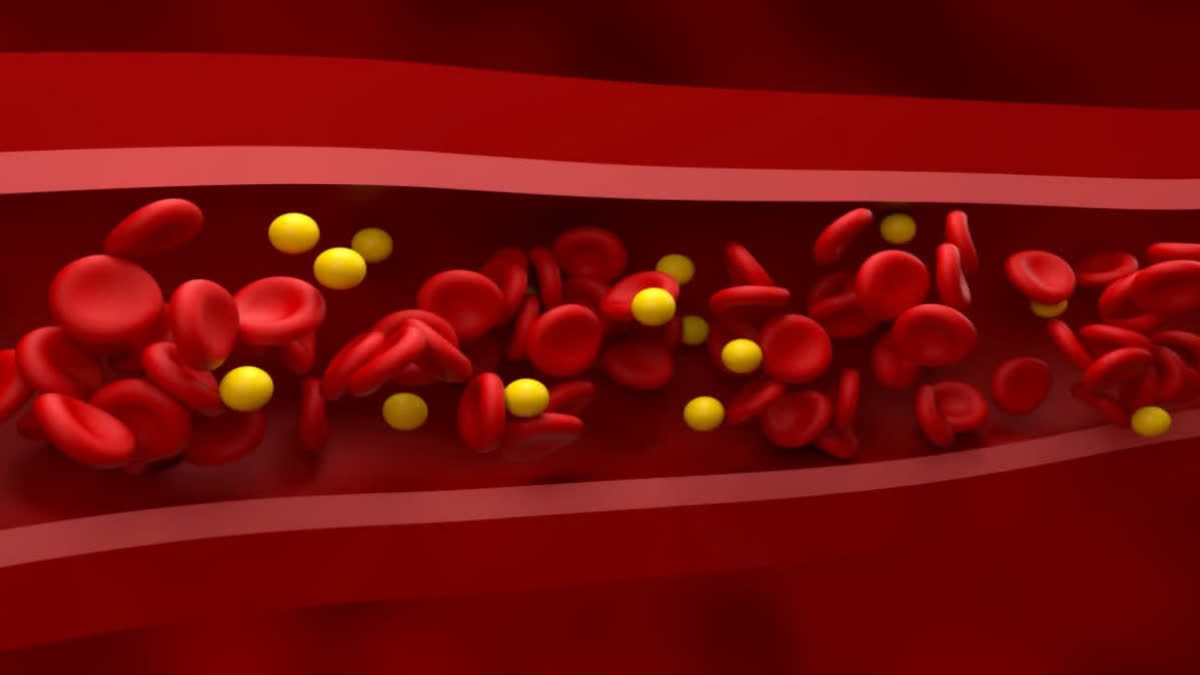 If You Feel Pain in These 5 Areas of Your Body, Your Cholesterol Levels ...