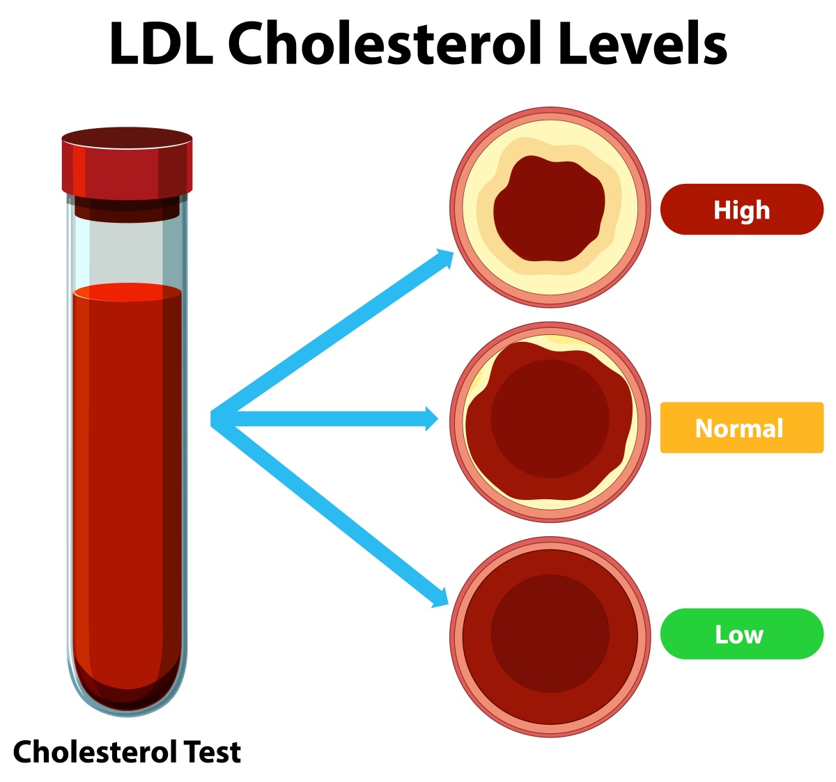 Essential Facts You Need To Know About Cholesterol And Oil